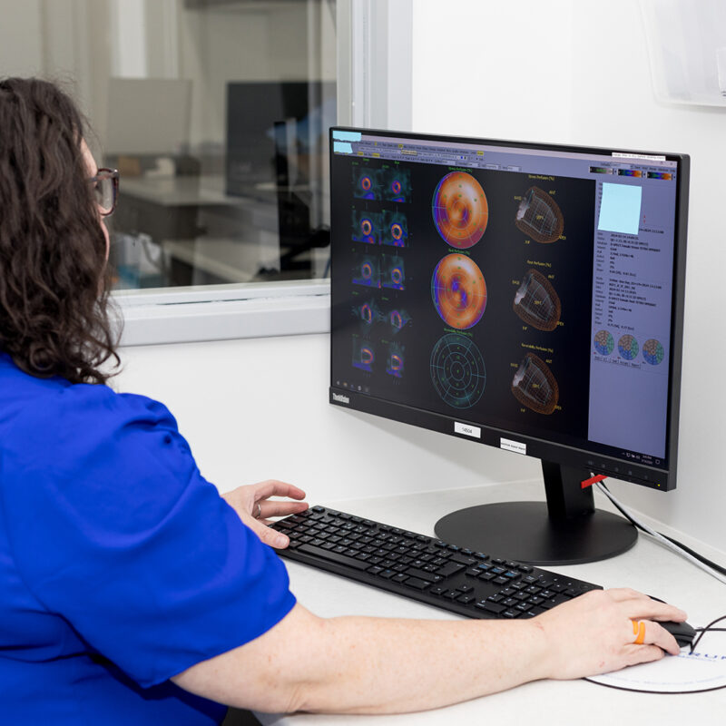 Nuclear Cardiology – Windsor Heart Institute